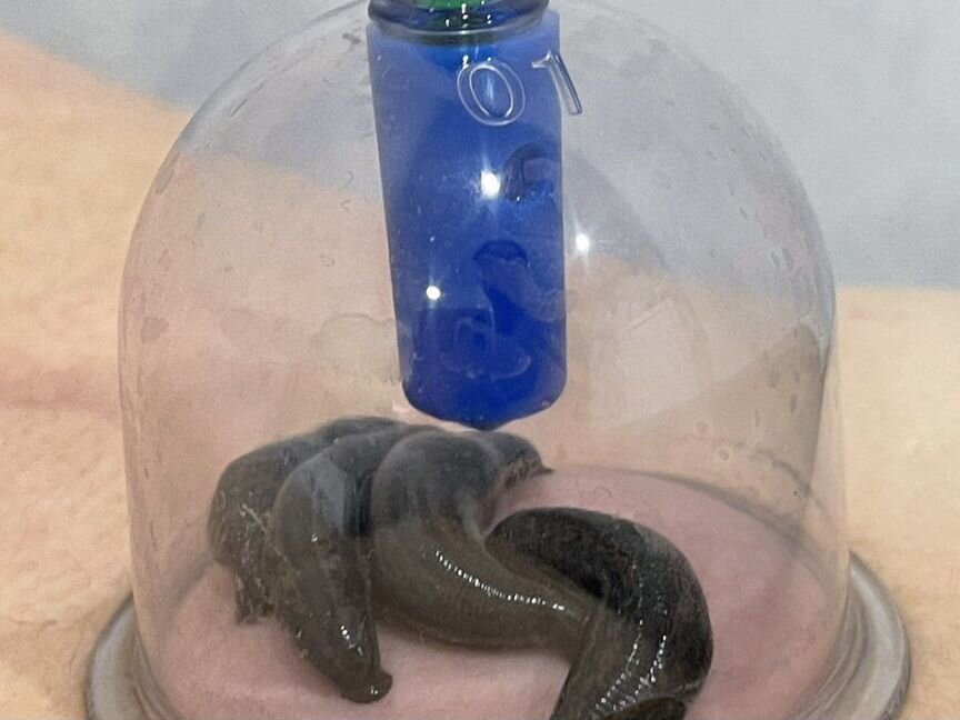 Пиявки постановка