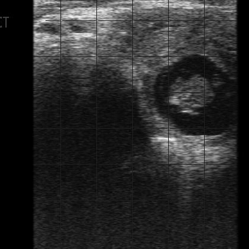 Ректальные иследования крс