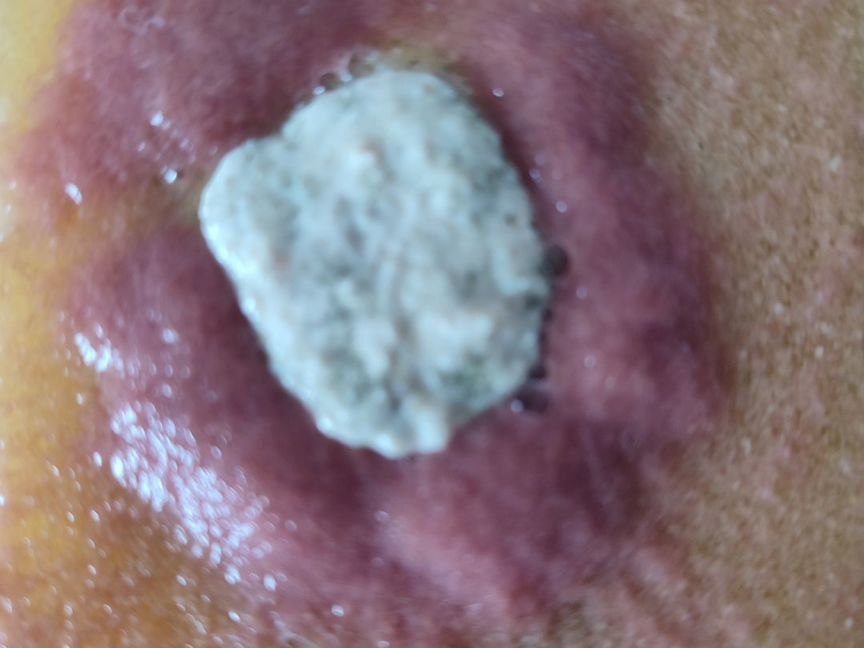 Живой корм аулофорус